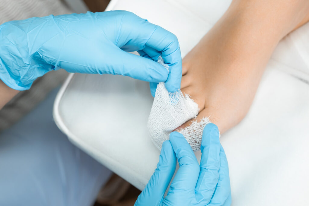 Missoula’s Venture Medical Acquires Biotech Assets to Expand Wound Care ...